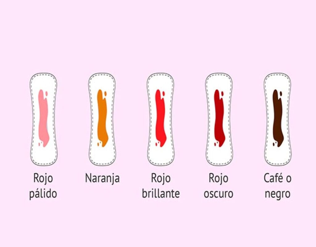 Retraso Menstrual y Flujo Blanco: Causas ¿Debo Preocuparme?